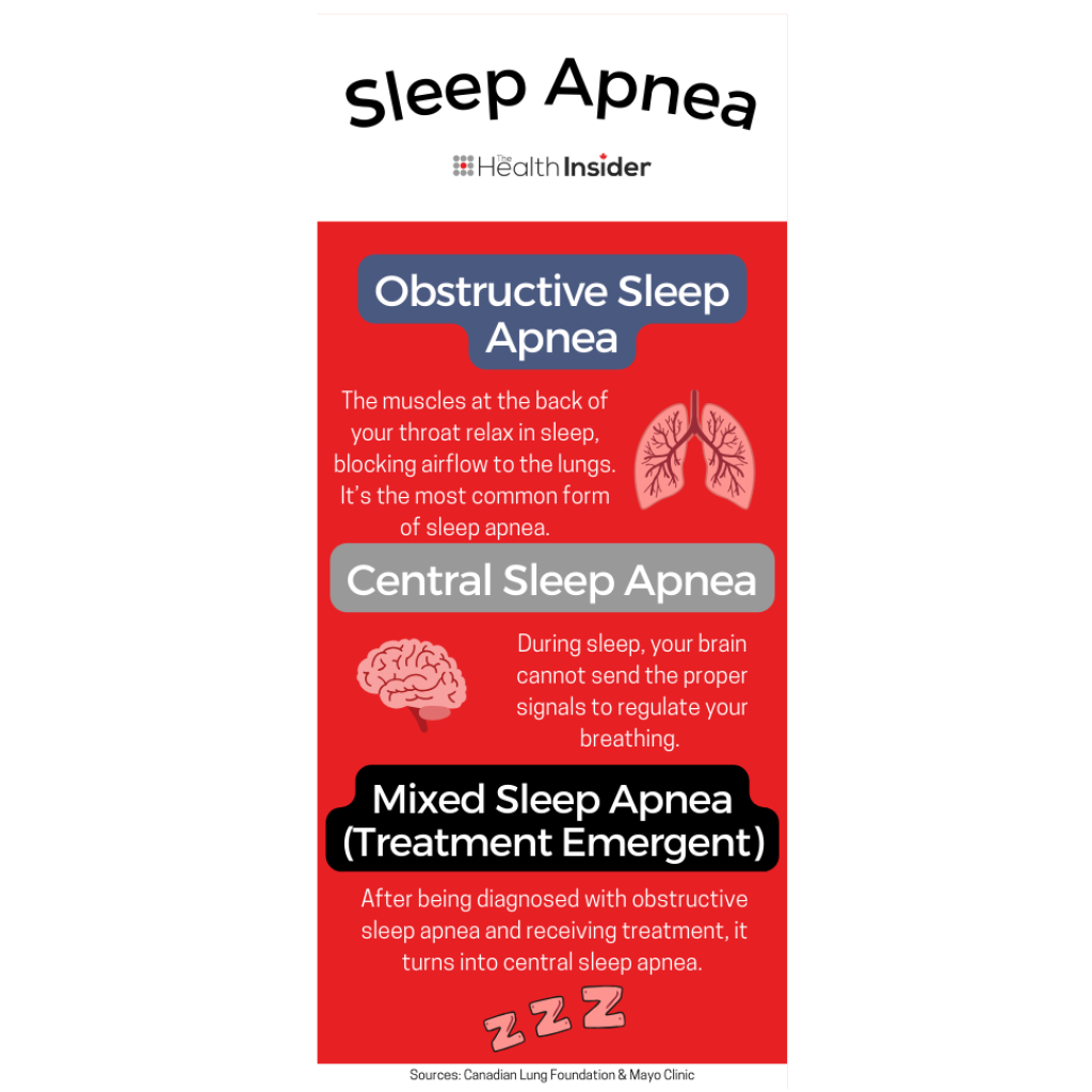 The Hazard of Ignoring Sleep Apnea: How it Can Trigger Alzheimer’s ...