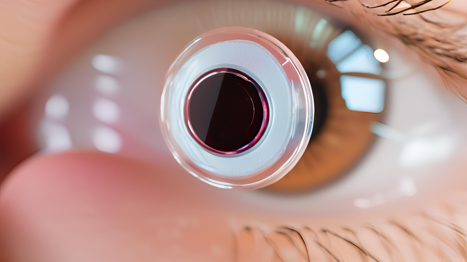 Smart Contacts and Ortho-K: Innovative Contact Lenses for Ease - The ...