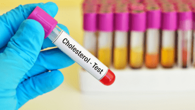 The Critical Cholesterol Test Your Doctor Might Be Missing | The Health ...
